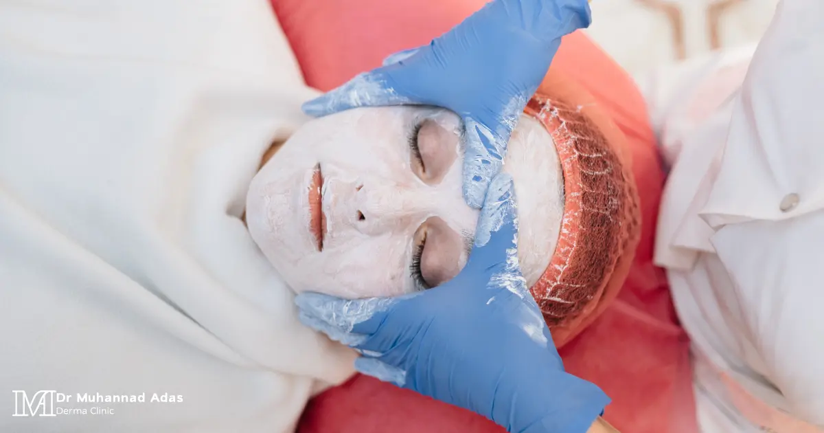 Cold Facial Peeling: Top 9 Benefits of Getting It Done at a ...